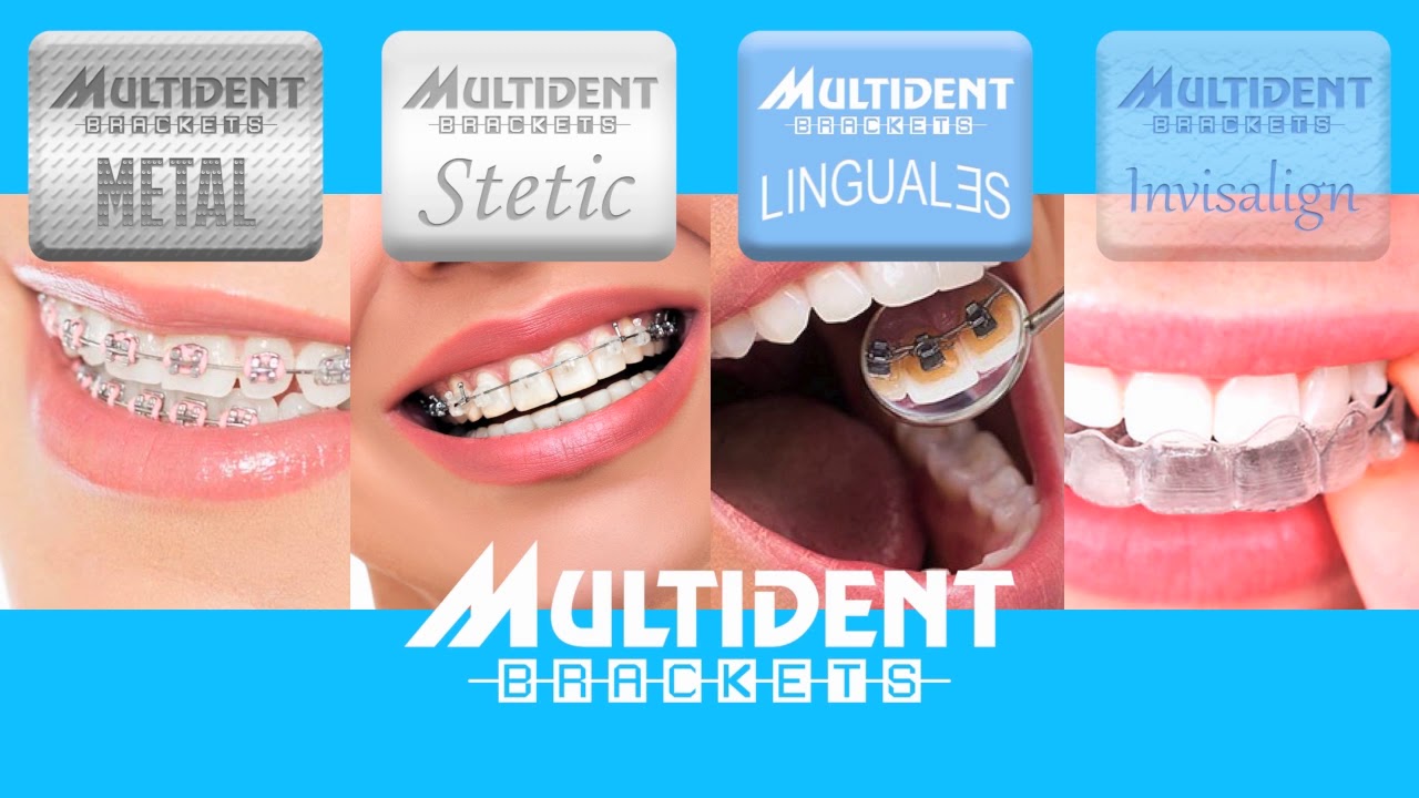 Multident Brackets - Síguenos en @MultidentMiraflores - YouTube