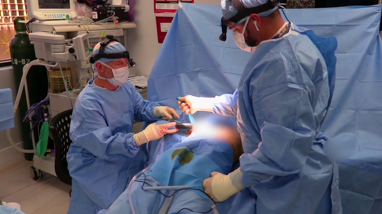 Transaxillary Breast Augmentation by Dr Fisher - 360cc Silicone ...