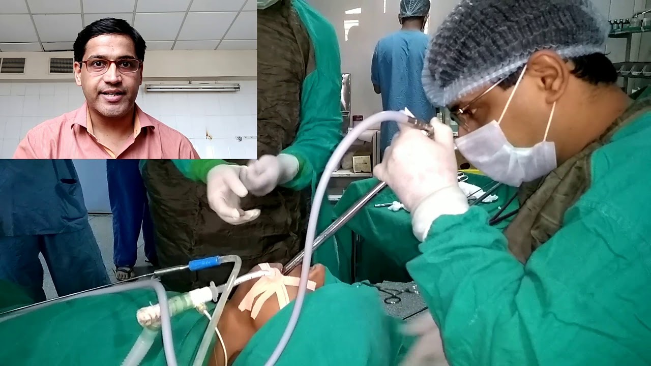 Oesophageal Dilatation - YouTube