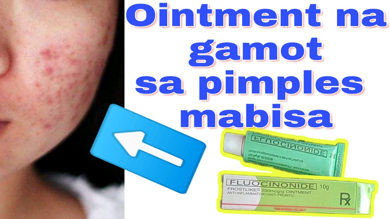 Mabisang gamot kontra pimples and disorder of skin, 100% effective ...