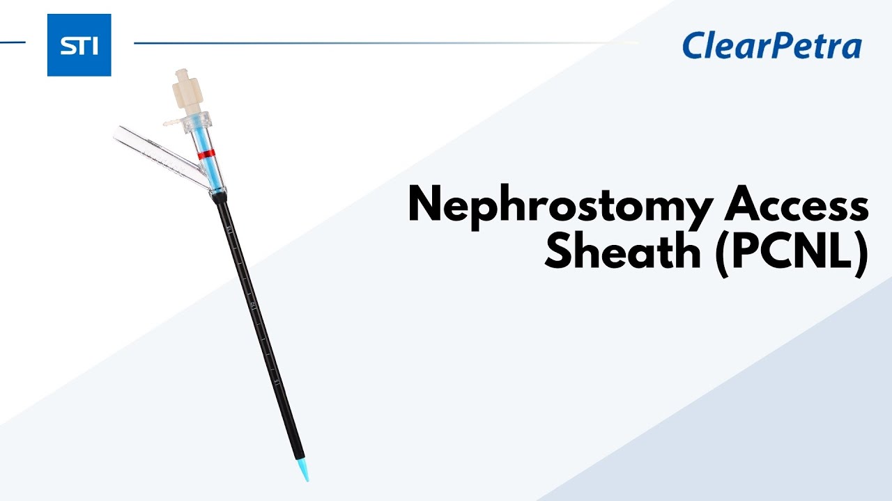 Nephrostomy Access Sheath PCNL - YouTube