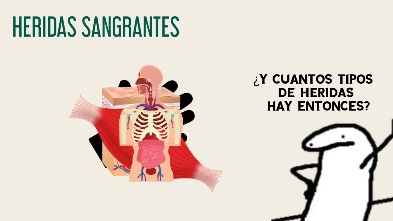 Cómo Tratar Heridas Sangrantes Parte 1/2 | Sintiendome Primeros ...