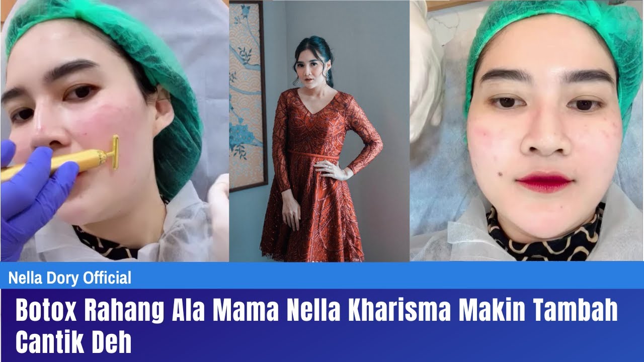Botox Rahang Ala Mama Nella Kharisma Makin Tambah Cantik Deh - YouTube