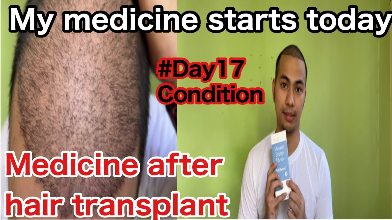 hair transplant medicines for first 2 months/ pehla 2 mahine ke liye ...