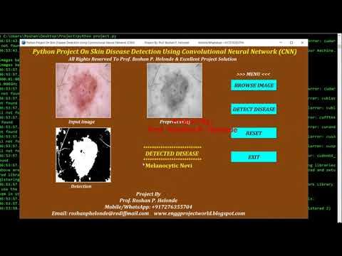 Skin Disease Detection Using CNN | Python OpenCV Keras Project Source ...