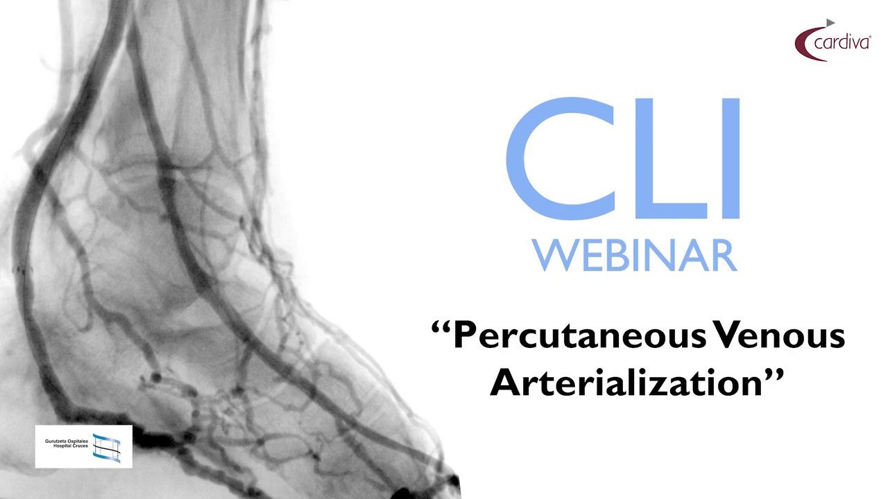 Webinar: 'Percutaneous Venous Arterialization' Drs. August Ysa and ...