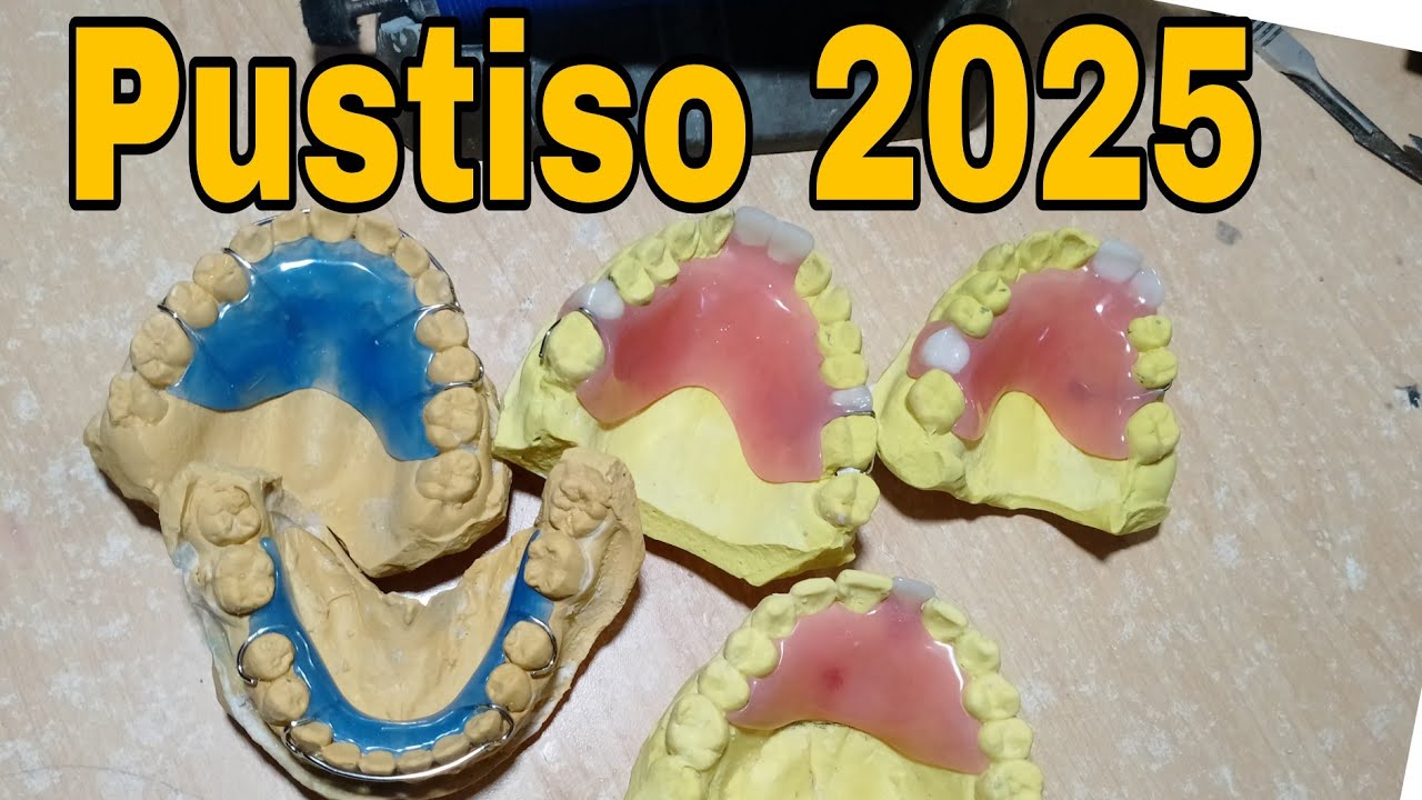 Pustiso Retainer 2025 - YouTube