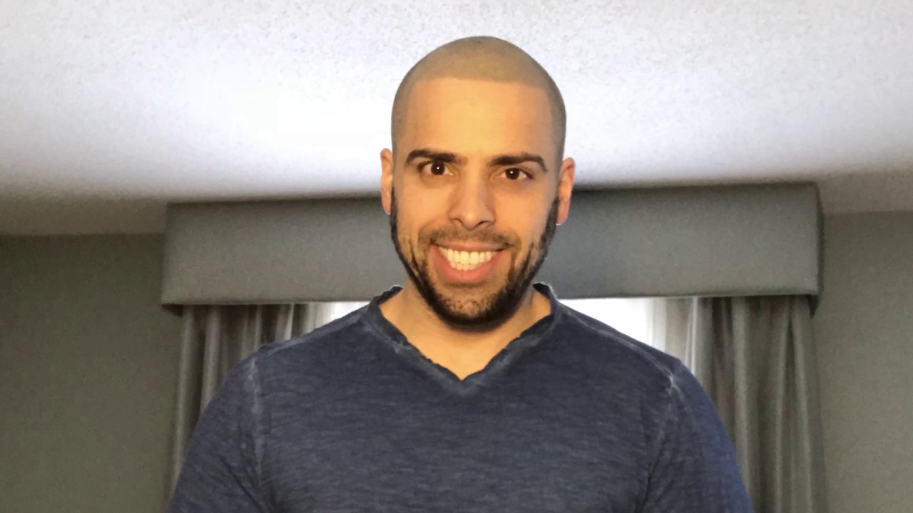 Scalp Micropigmentation (Hair Tattoo) ~ 6 Week Follow Up with Matt ...
