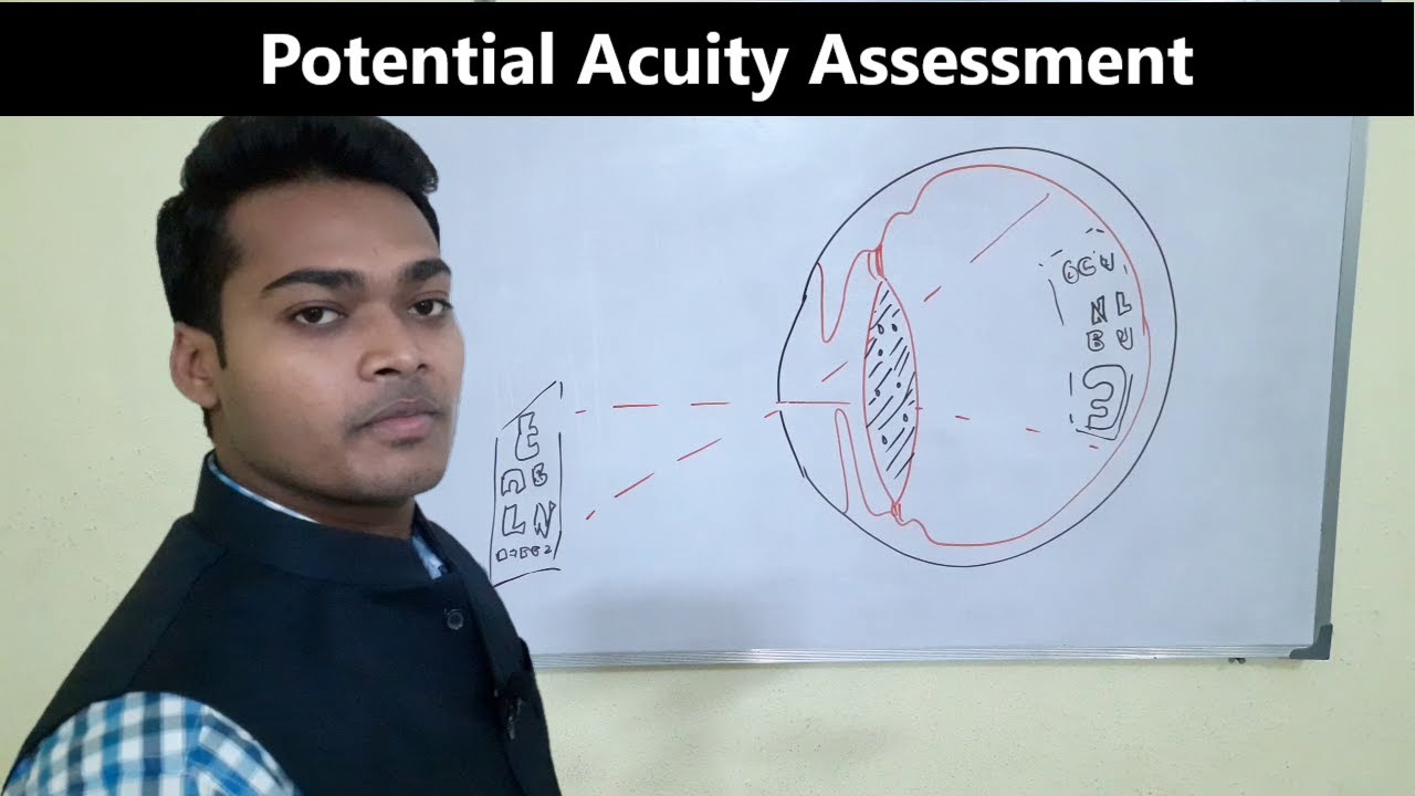 potential acuity meter - YouTube