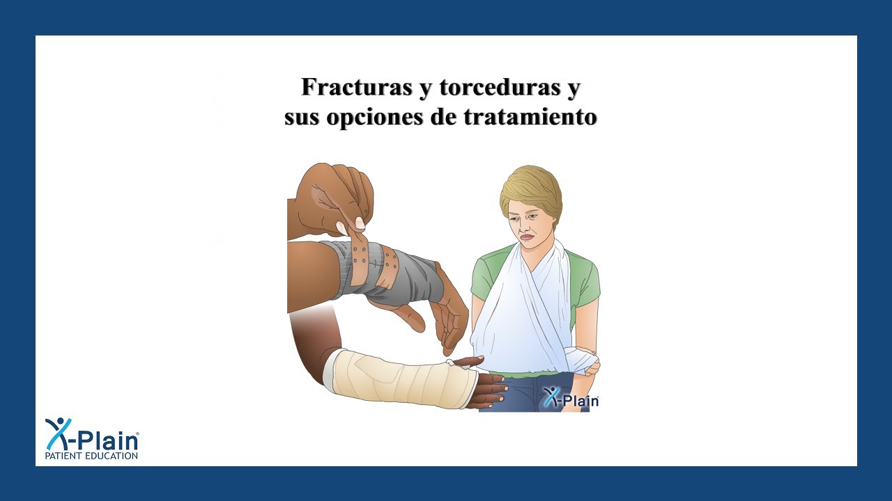 Fracturas y torceduras y sus opciones de tratamiento - YouTube