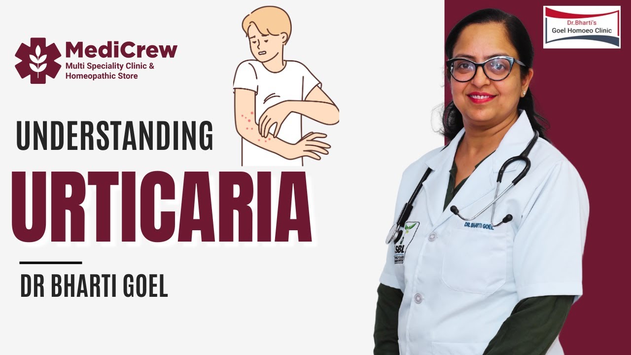 Understand Urticaria Dr Bharti Goel | MediCrew | Experience In ...