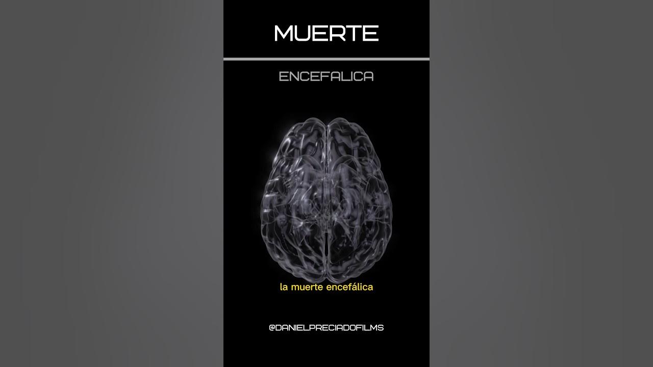 ¿sabes Que Es La Muerte Encefálica Enfermedades Medico