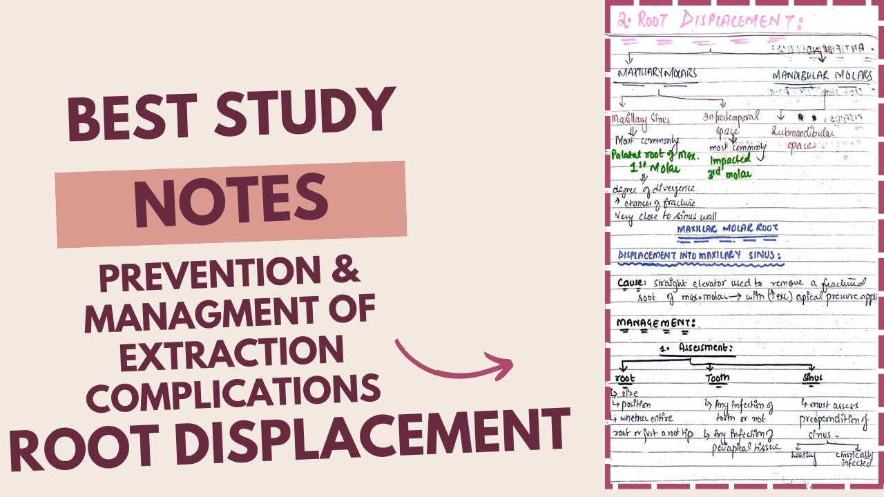 Maxillary Root Displacement | Prevention and Management | Extraction ...