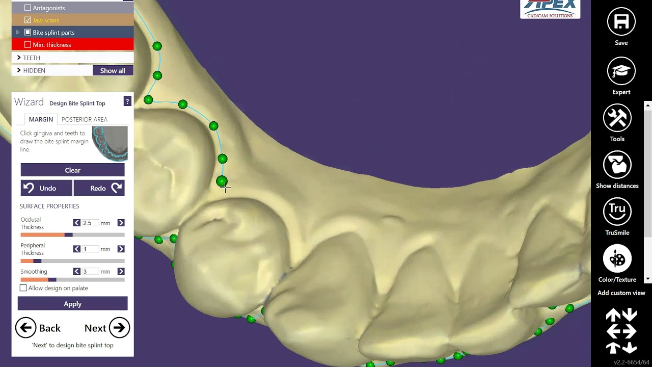 bite splint - YouTube