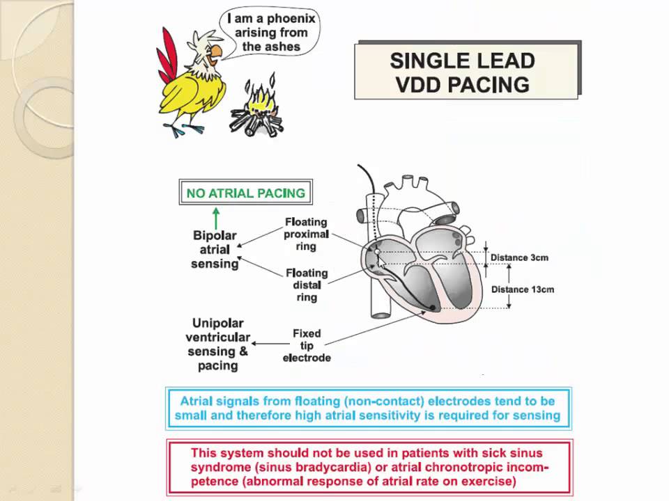 Dual chamber PPM - YouTube
