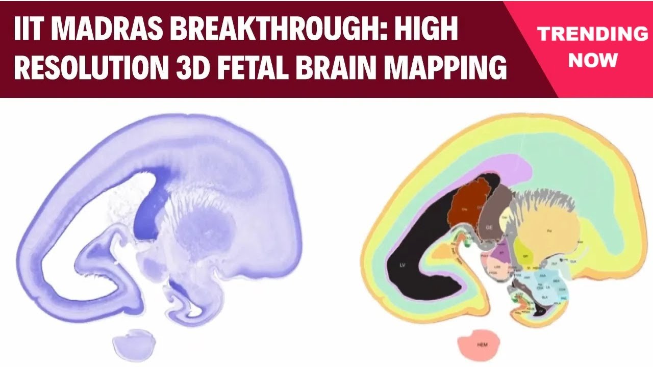 IIT Madras Released 3D High Resolution Images of Human Fetal Brain ...