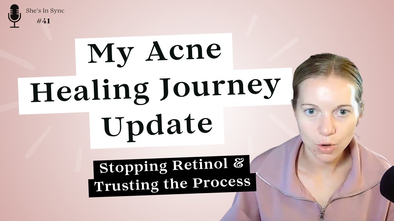 My Acne Healing Journey Update: Stopping Retinol and Learning to Trust ...