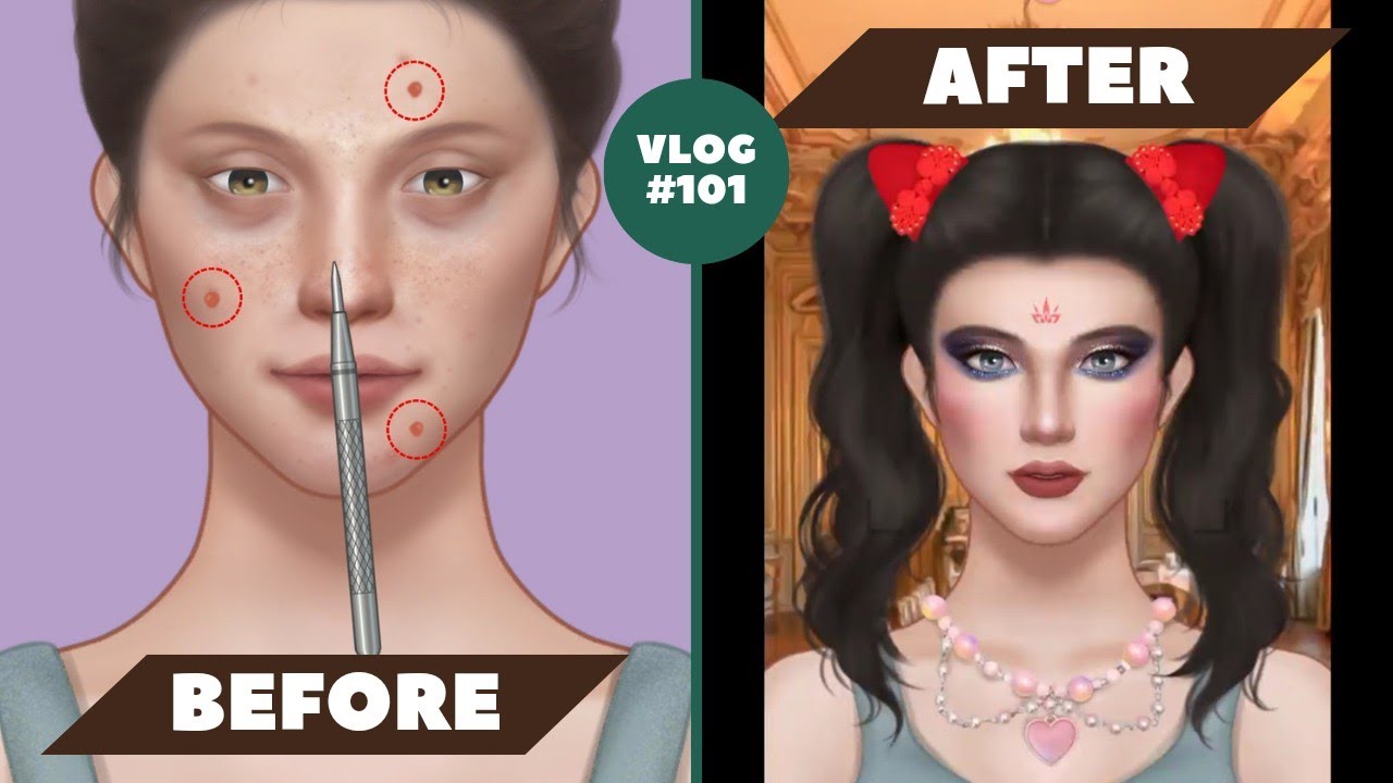 Pimple Removal ASMR | Pimples Remove Kaise Kare | Pimple Popping | Pimple Patch ...