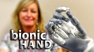 I Limb Bionic Hand