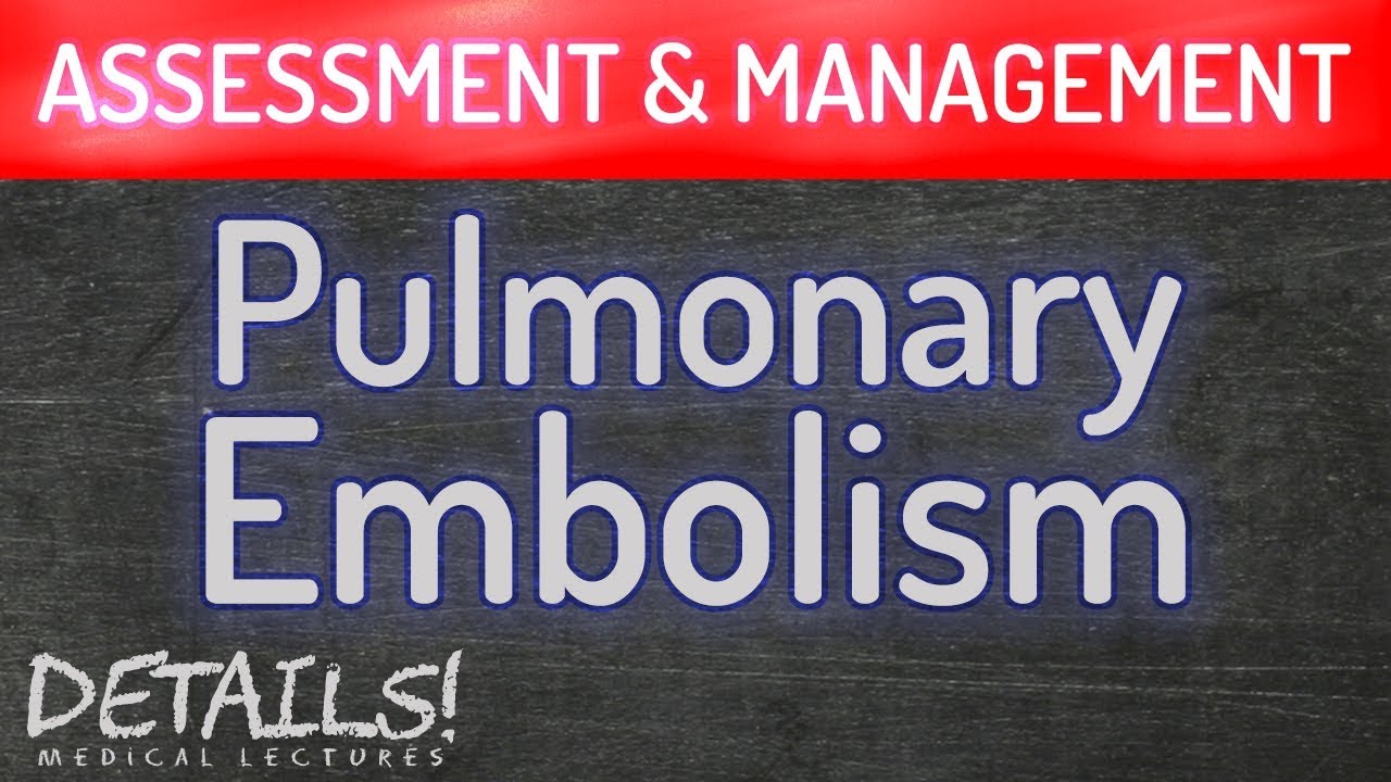 Pulmonary Embolism | Assessment & Management | Details - YouTube