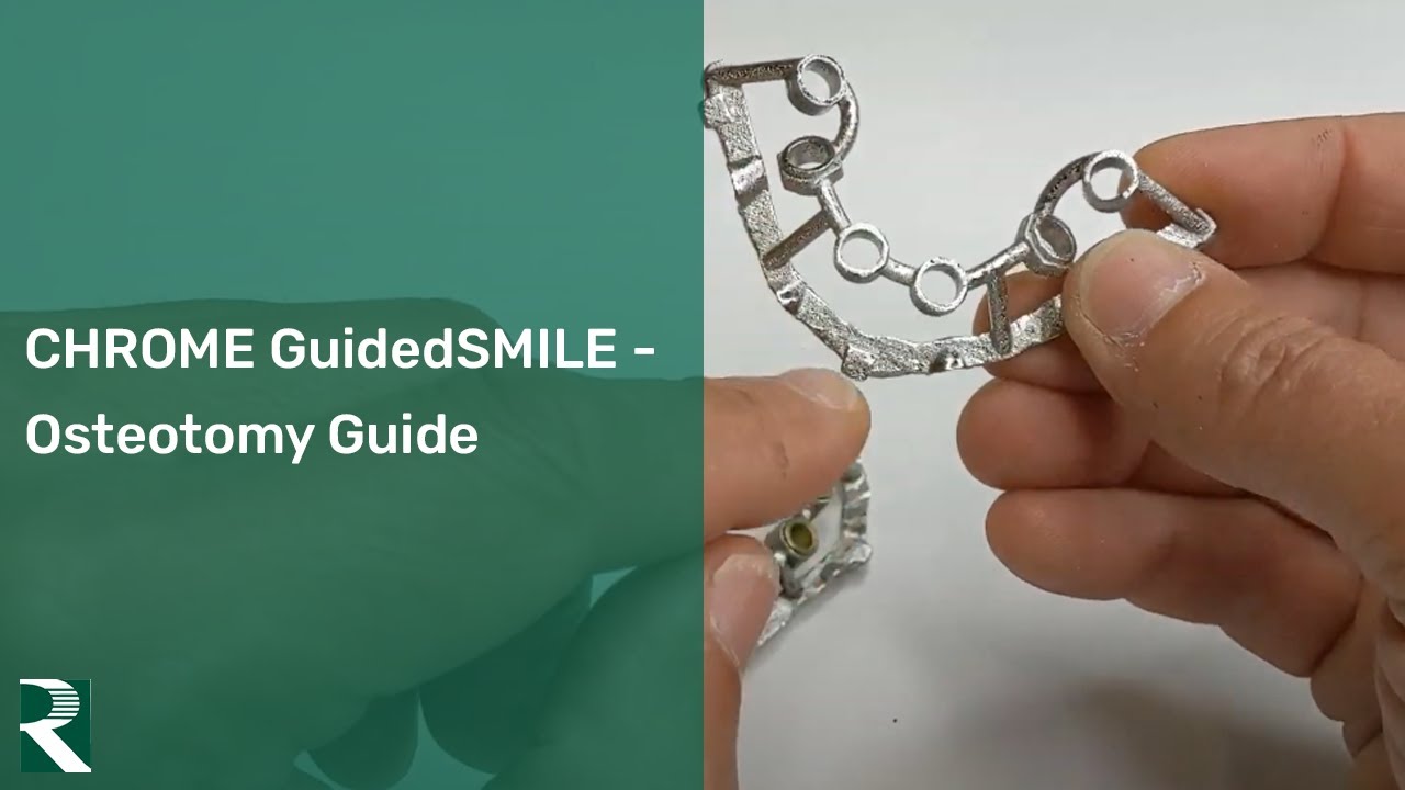 CHROME GuidedSMILE - Osteotomy Guide - YouTube