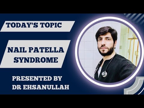 Nail patella syndrome (signs/symptoms) pathology diagnosis Treatments ...