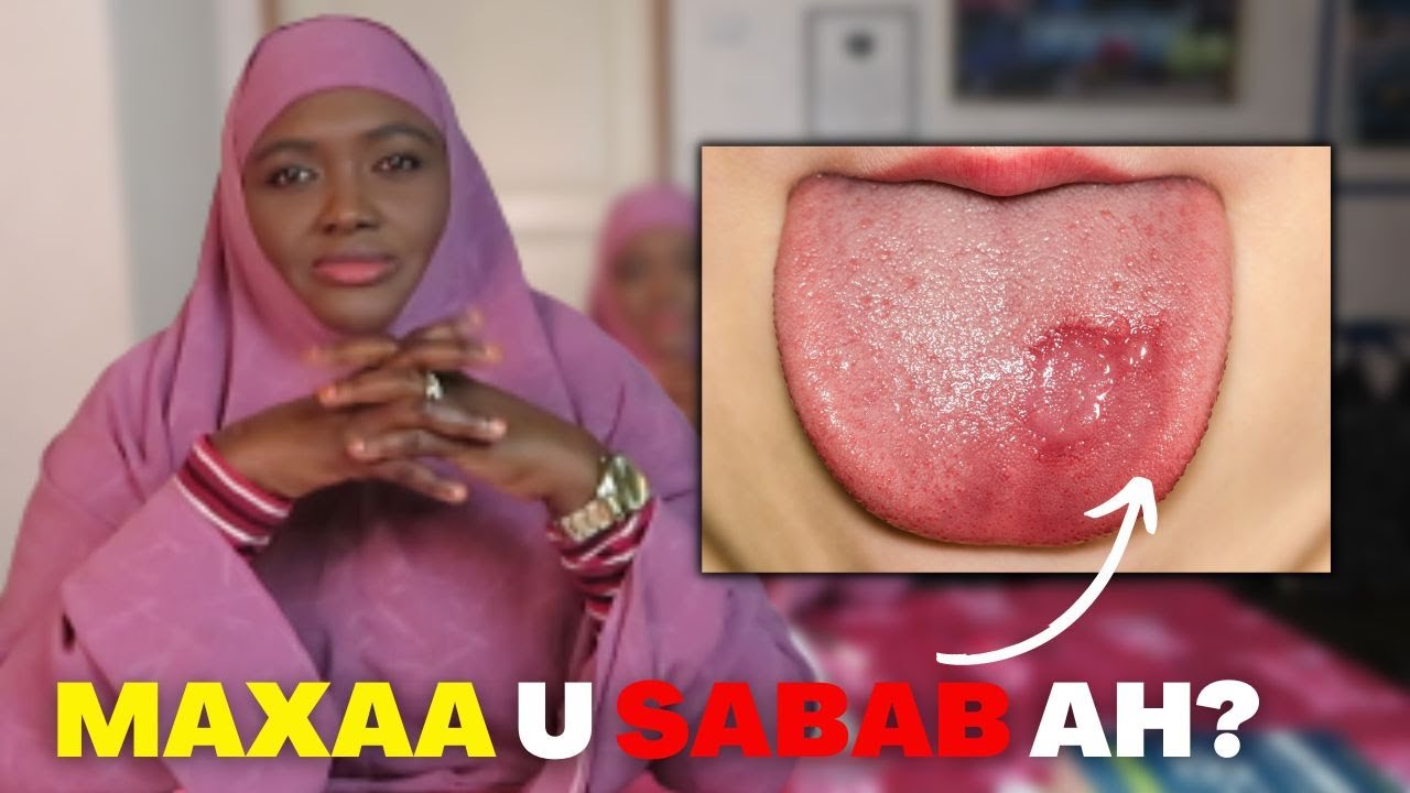 MAXAA KEENI KARO DHAAWACYADA CARABKA? - YouTube