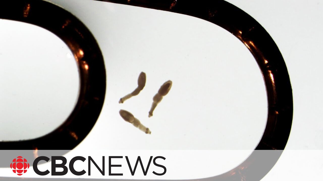 Alberta doctors warn about parasitic tapeworm spread through infected ...