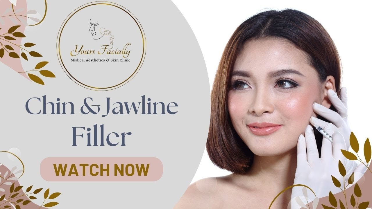 Facial Fillers - Yours Facially Aesthetics