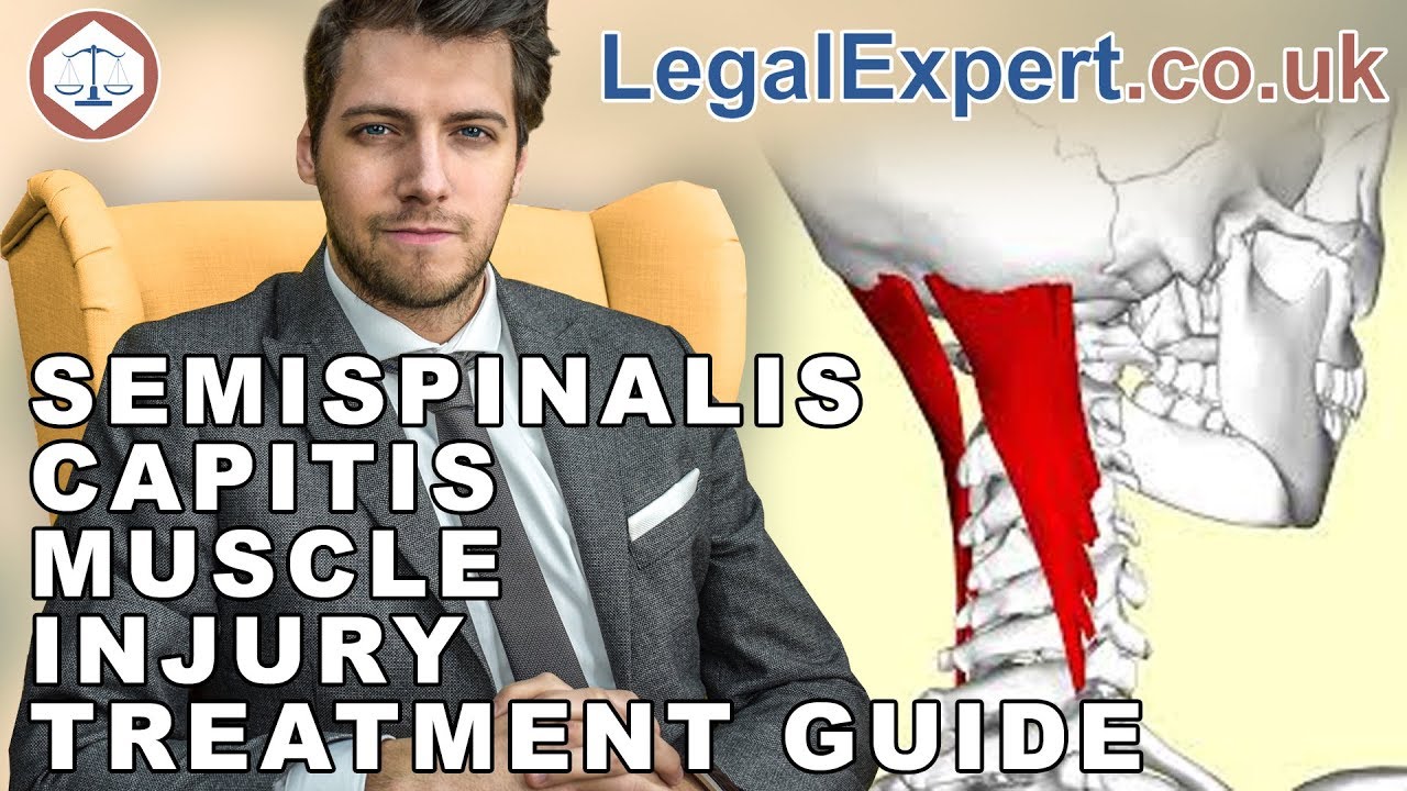Semispinalis Capitis Muscle Injury Treatment Guide ( 2019 ) UK - YouTube