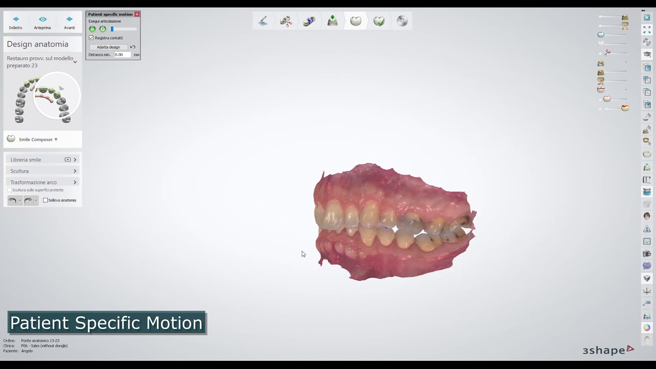 3Shape Patient Specific Motion and FaceScan - YouTube