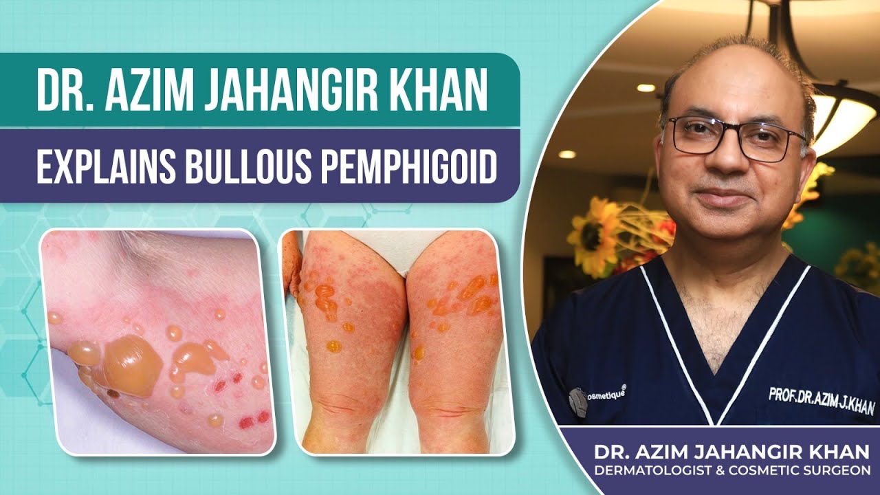 Bullous pemphigoid: Diagnosis, Symptoms, Treatment | Explained By Prof ...