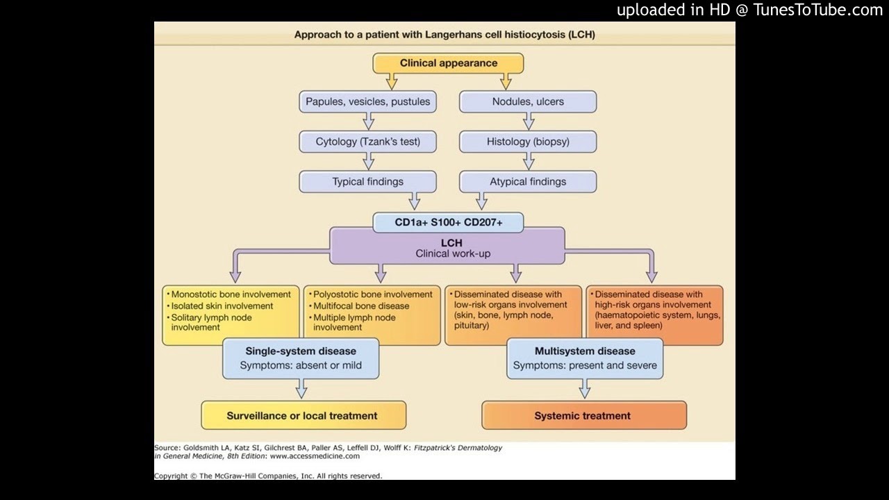 Adult Langerhans cell histiocytosis (LCH) - YouTube