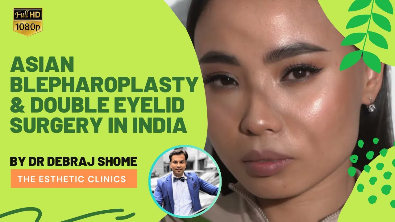 Asian Blepharoplasty & Double Eyelid Surgery to Create Aesthetic ...