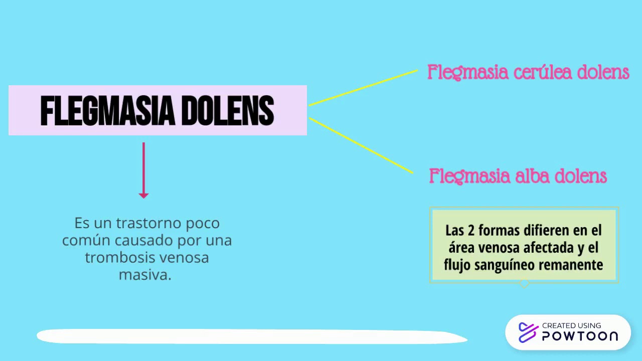 Flegmasia alba dolens - YouTube