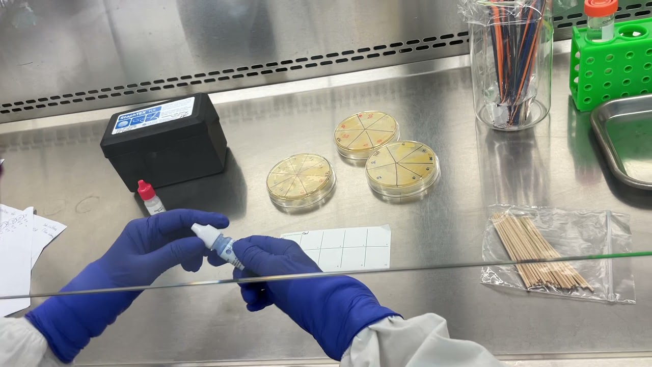 Coagulase Test for Staphylococcus aureus - YouTube