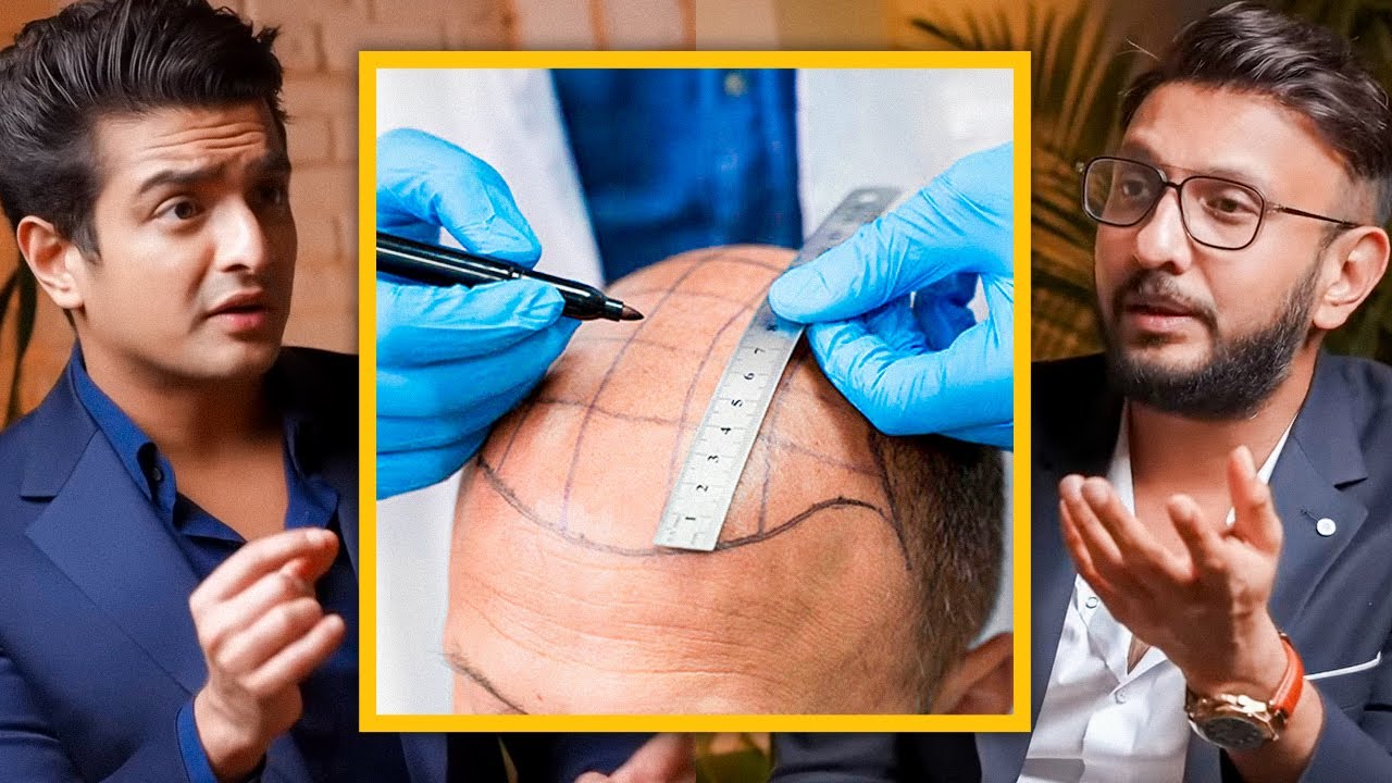 Before Your Hair Transplant Surgery, Watch This (Top Dermat Dr.Pilani ...