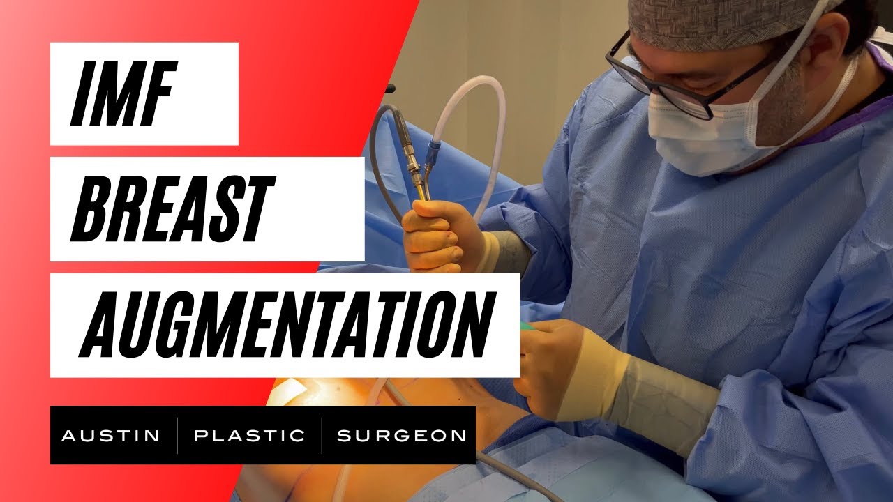 Gummy Bear Breast Augmentation Surgery | Austin Plastic Surgeon ...