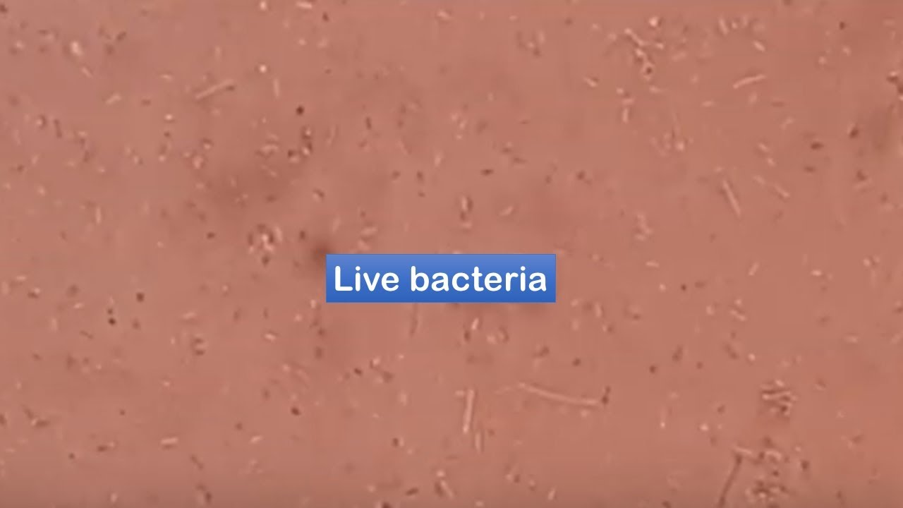Live bacteria under the Microscope - YouTube