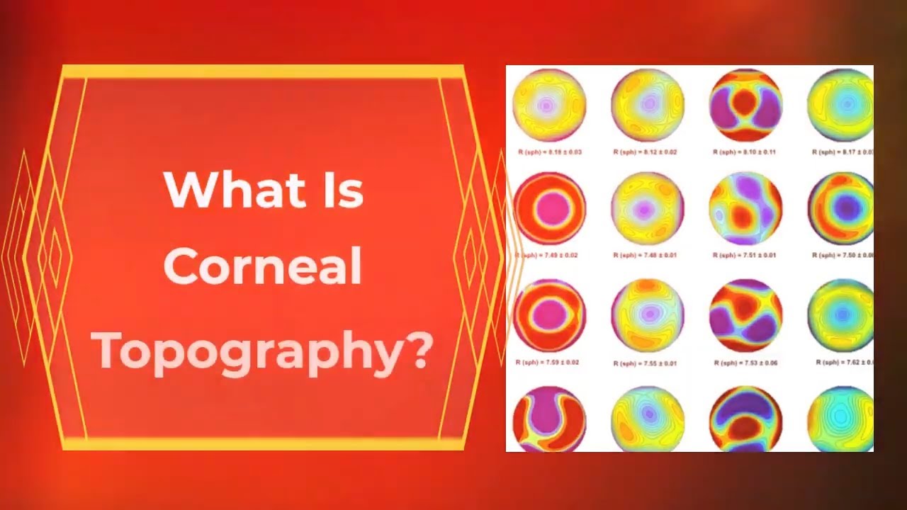 What is Corneal Topography? - YouTube