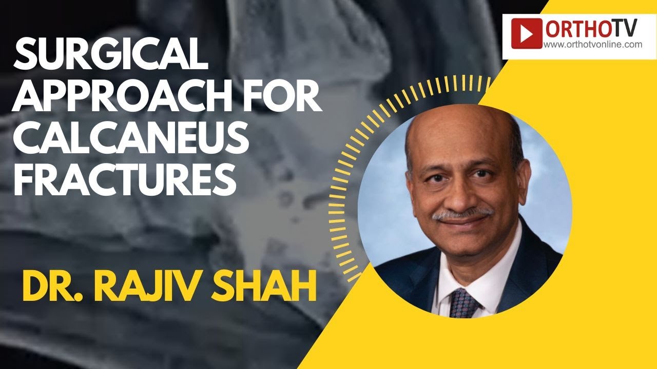 16th Ortho-TV Webinar Surgical Approach for Calcaneus Fractures by Dr ...