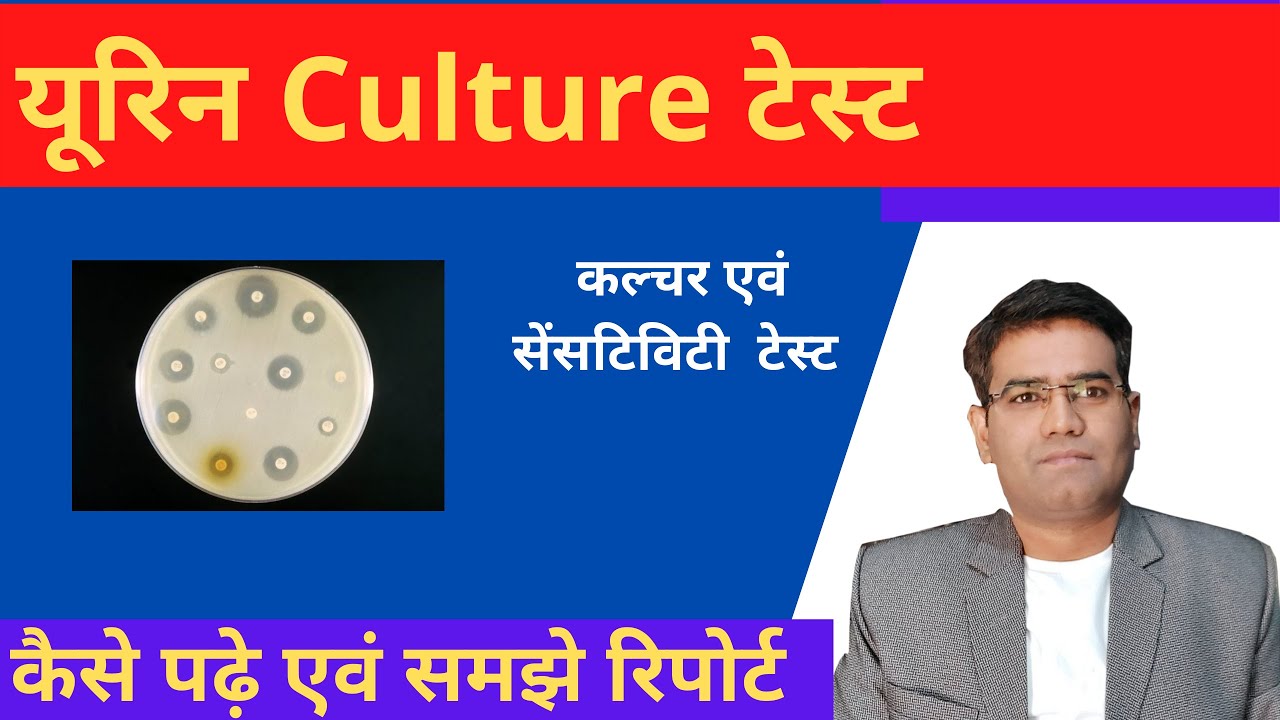 Urine Culture Test in Hindi I Culture And Sensitivity Test Result urine-culture-test-in-hindi-i-culture-and-sensitivity-test-result
