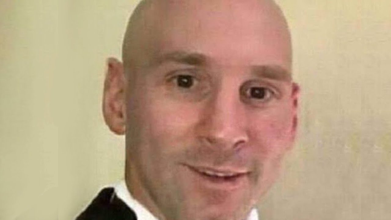 memes que curam a calvíce 👨‍🦲 - YouTube