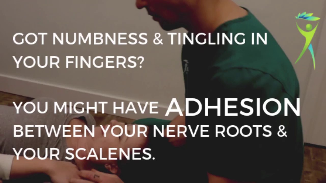 Adhesion Treatment for Finger Numbess and Tingling [Nerve Roots at ...