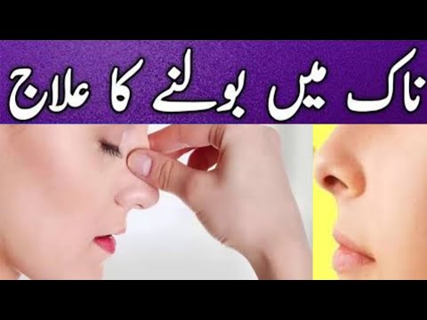 nak me bolny ka ilaj in urdu hindi