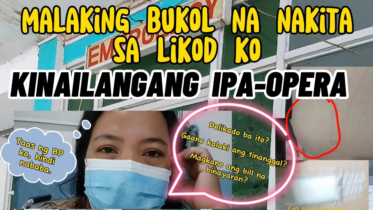 #67 TINANGGAL ANG MALAKING BUKOL SA LIKOD KO + MAGKANO ANG BINAYARAN ...