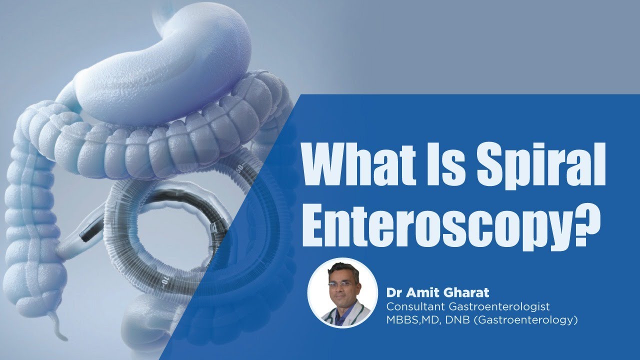 What Is Spiral Enteroscopy? | Medicover Hospitals - YouTube