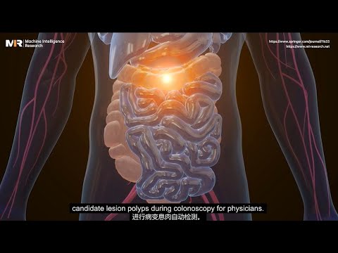 【MIR Series】Video Polyp Segmentation: A Deep Learning Perspective - YouTube
