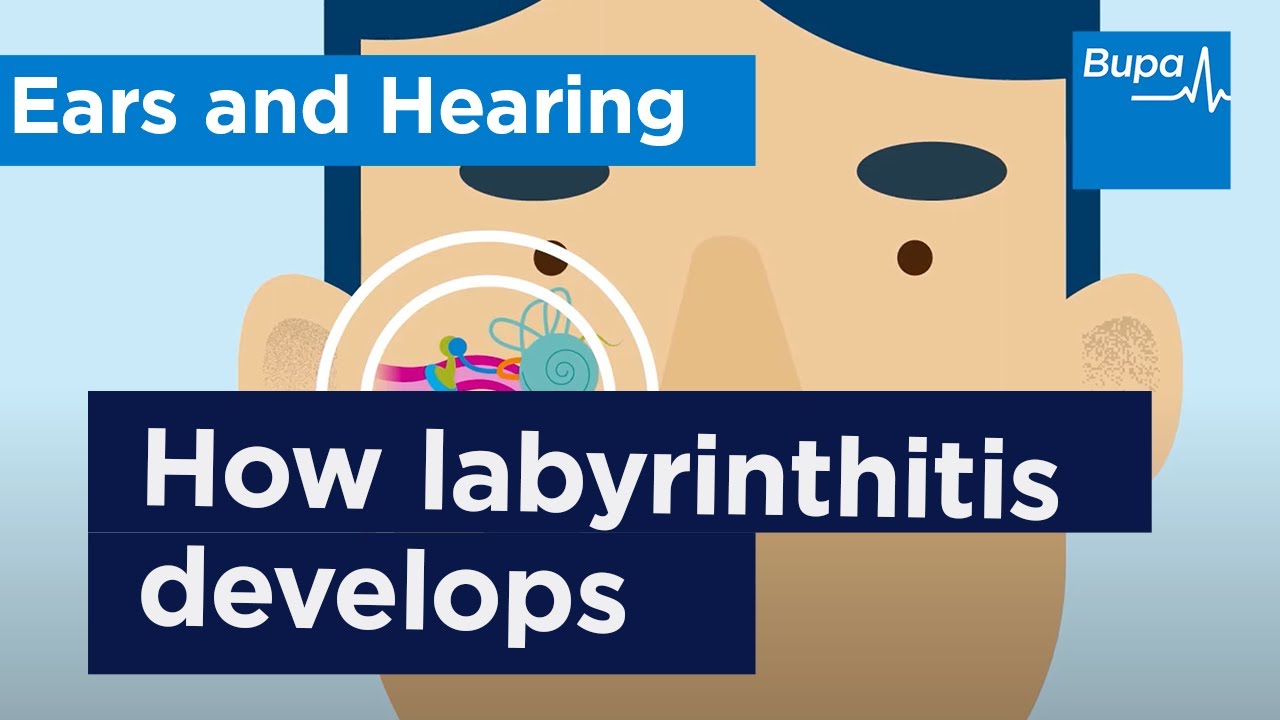 Labyrinthitis Exercises