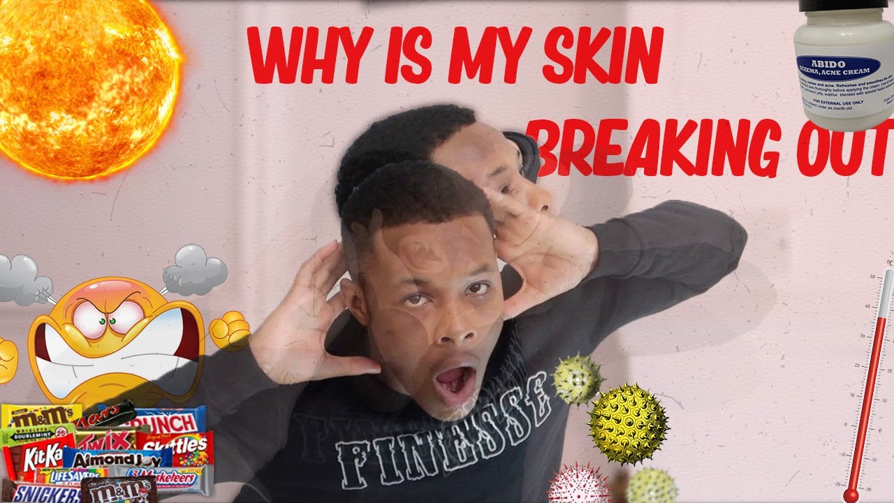 WHAT CAUSES SKIN BREAK OUTS | TRIGGERS OF THE SKIN - YouTube